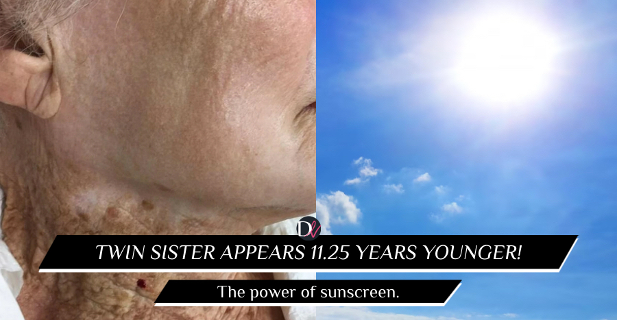 Shocking photos that prove sunscreen should be your new best friend ...