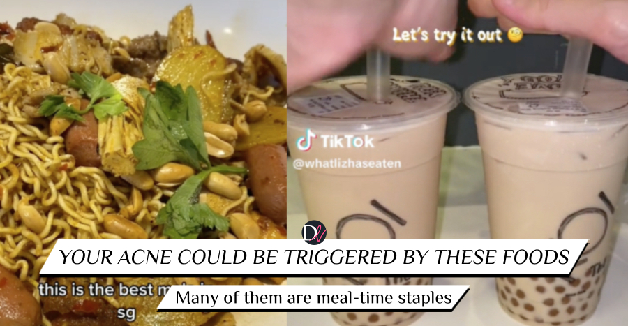 5 well-loved local foods that could be aggravating your acne, including ...